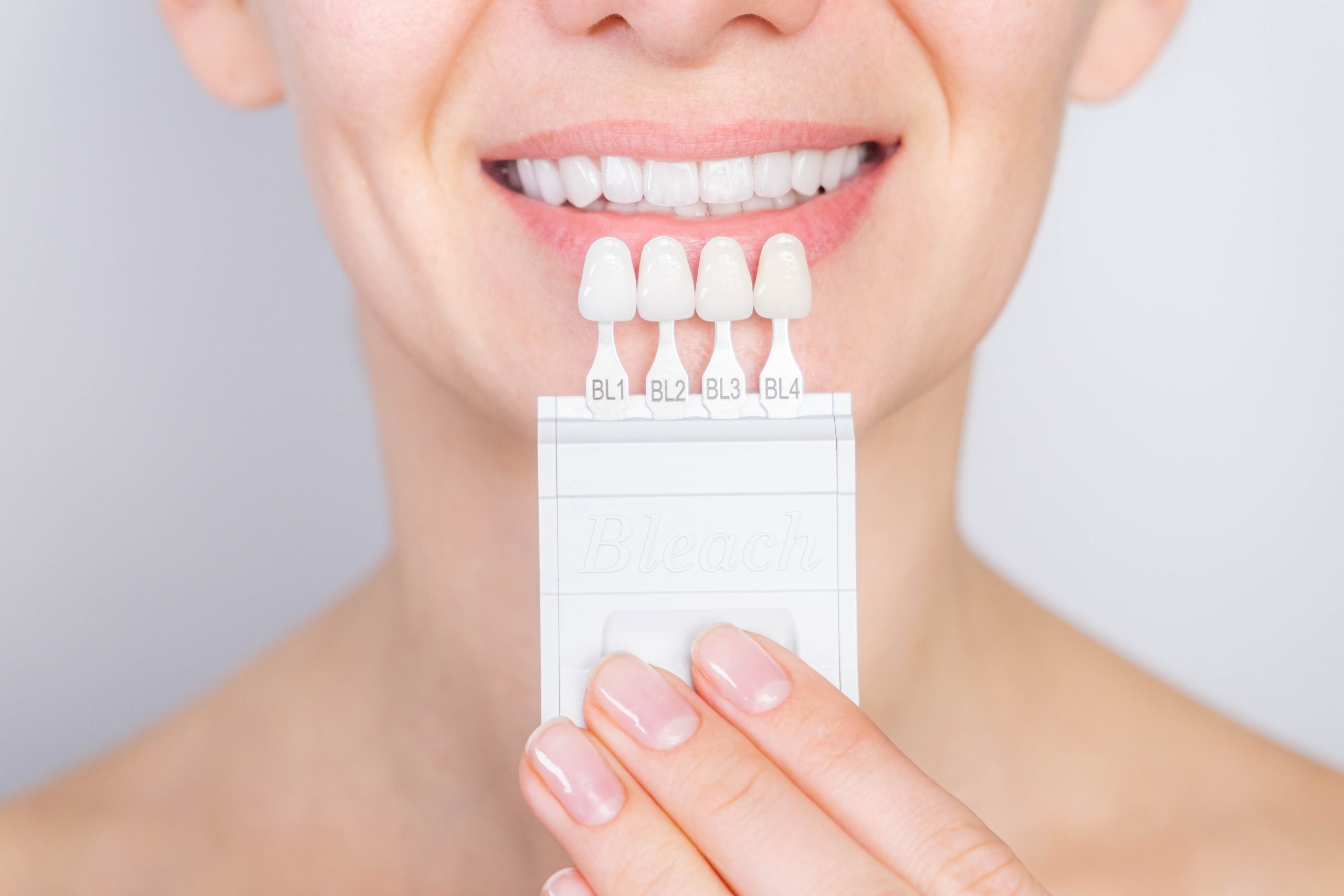 Are Veneers Worth It? Pros, Cons, and What to Expect